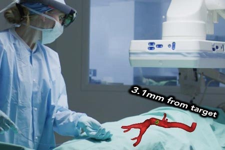 Centerline Biomedical Wins SBIR Phase II Award from NIH