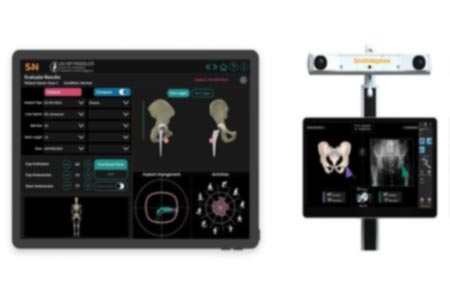 Smith+Nephew announces first total hip replacement cases on its CORI ...